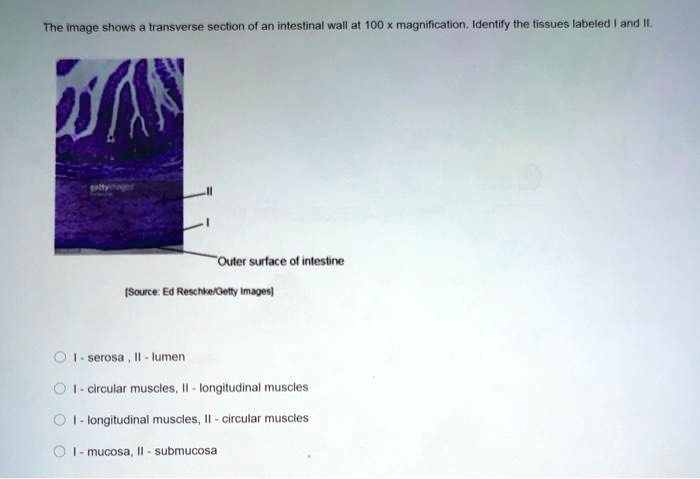 SOLVED: The image shows a transverse section of an intestinal wall at ...