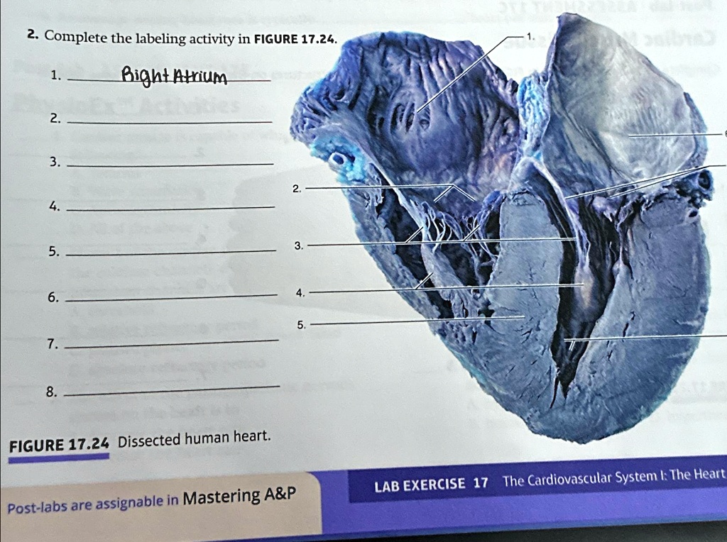 2. Complete the labeling activity in FIGURE 17.24. 1. Right Atrium ...