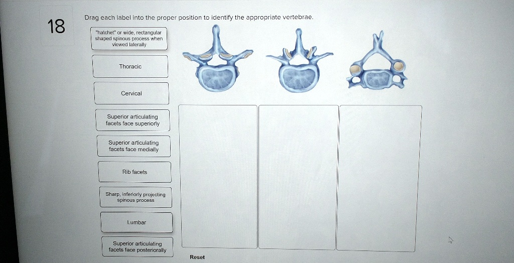 18 Drag each label into the proper position to identify the appropriate vertebrae. "hatchet" or ...