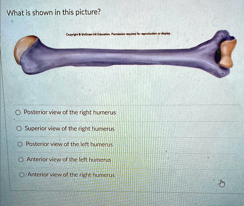 [GET ANSWER] What is shown in this picture? Copyright © McGraw-Hill ...