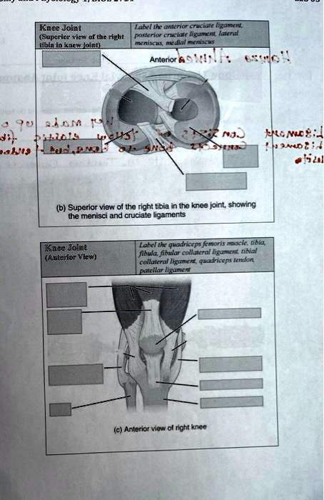 SOLVED: Knee Joint (Superior view of the right tibia in knee joint ...