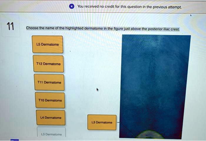 [GET ANSWER] 11 Choose the name of the highlighted dermatome in the ...