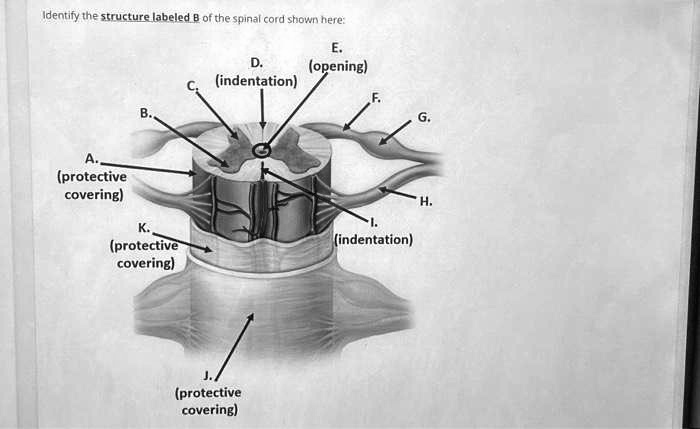 Identify the structure labeled B of the spinal cord shown...