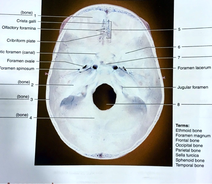 SOLVED: bone Crista galli Olfactory foramina 5 Cribriform plate 6 tic ...