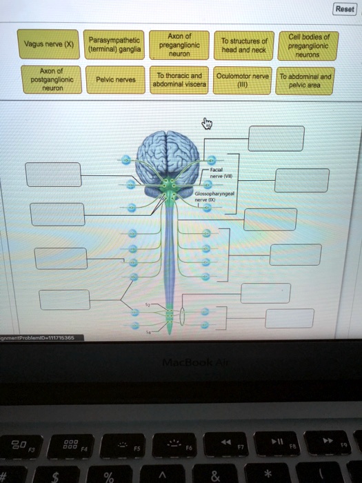 SOLVED: Parasympathetic (terminal) ganglia Axon of preganglionic neuron ...