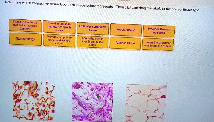 Determine which connective tissue type each image below...