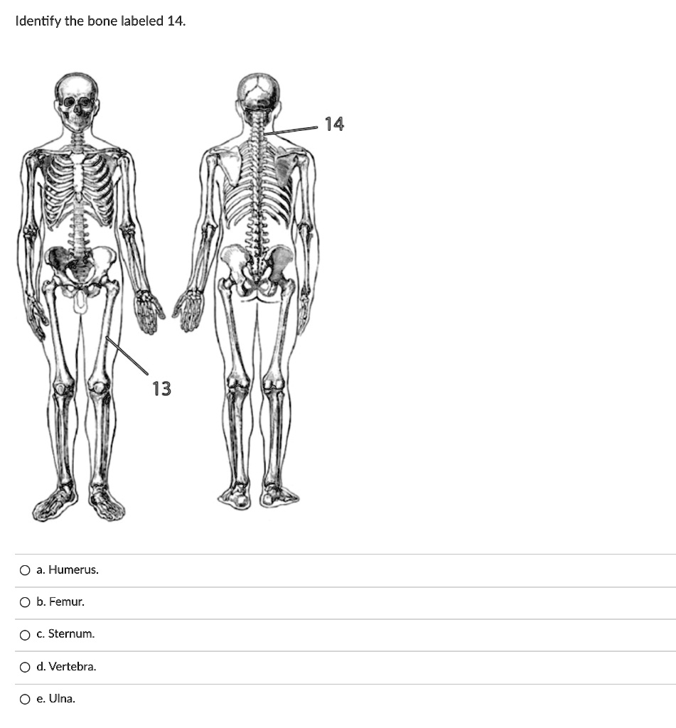 SOLVED: Identify the bone labeled 14 14 13 O a. Humerus. O b. Femur. O ...