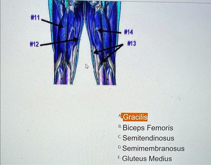 VIDEO solution: A. Gracilis, Biceps Femoris, C. Semitendinosus, D ...