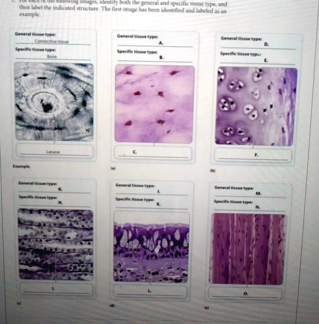 need tissue types and specific names options are nervous tissue byline ...