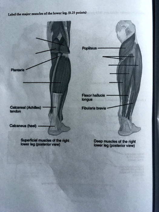 Label the major muscles of the lower leg. (0.25 points) Plantaris ...