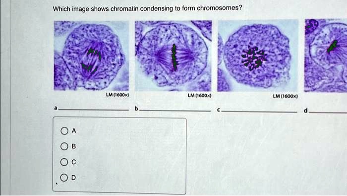 Which image shows chromatin condensing to form...