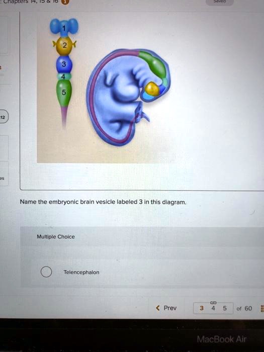 SOLVED: Name the embryonic brain vesicle labeled 3 in this diagram ...