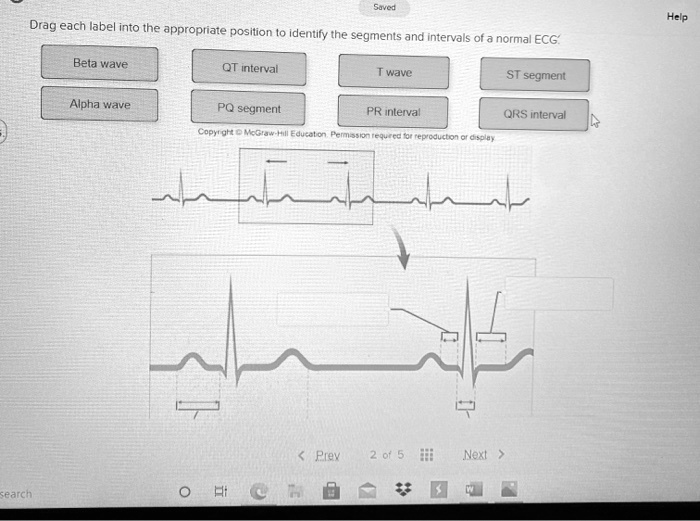 SOLVED: Text: Saved Drag each label into the appropriate position to identify the segments and ...