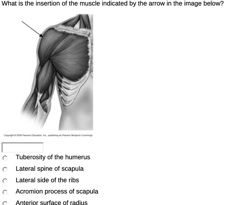 SOLVED: 'What is the insertion of the muscle indicated by the arrow in ...