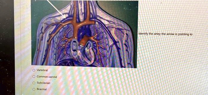 SOLVED: Texts: O Vertebral Common carotid Subclavian Brachial Identify the artery the arrow is ...