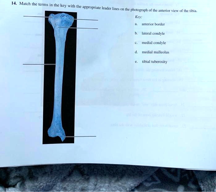 SOLVED: Match the terms in the key with the appropriate label: 1 ...