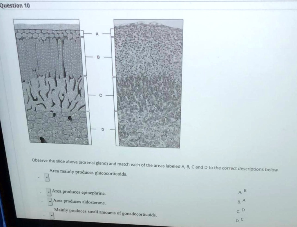 Question 10 Observe the slide above (adrenal gland) and...