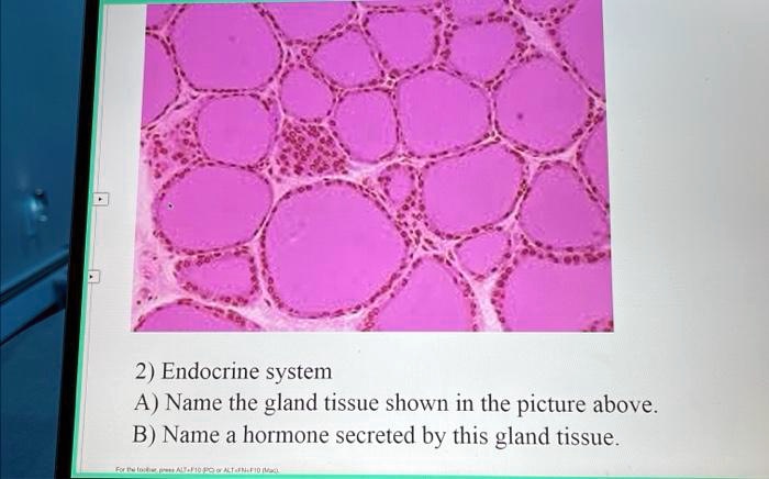 SOLVED: Endocrine system: A. Name the gland tissue shown in the picture above. B. Name a hormone ...