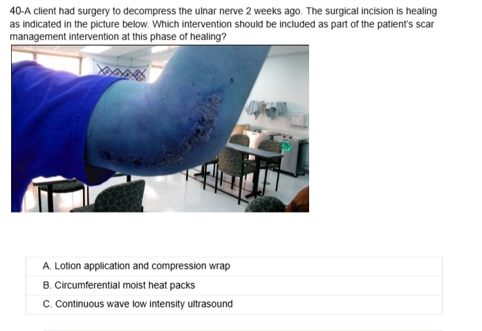 40 a client had surgery to decompress the ulnar nerve 2 weeks ago the ...