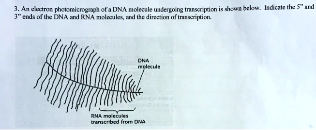 SOLVED: 3 . An electron photomicrograph of DNA molecule undergoing ...