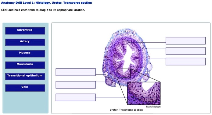 SOLVED: Please help with this diagram! Thank you! Anatomy Drill Level 1 ...