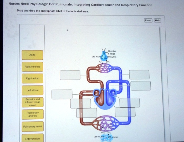 SOLVED: Nurses Need Physiology: Cor Pulmonale: Integrating ...
