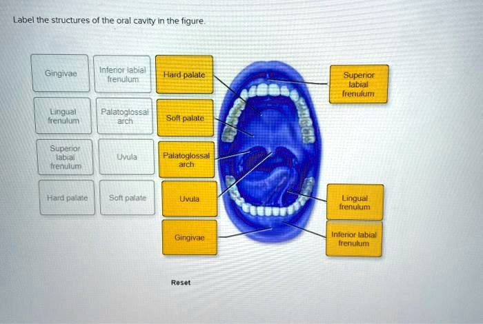 SOLVED: Label the structures of the oral cavity in the figure: Gingivae ...
