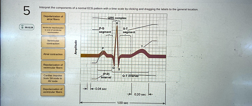 interpret the components of a normal ecg pattern with a time scale by ...
