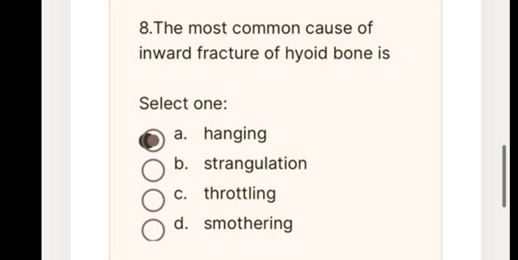 8. The most common cause of inward fracture of hyoid bone is Select one ...