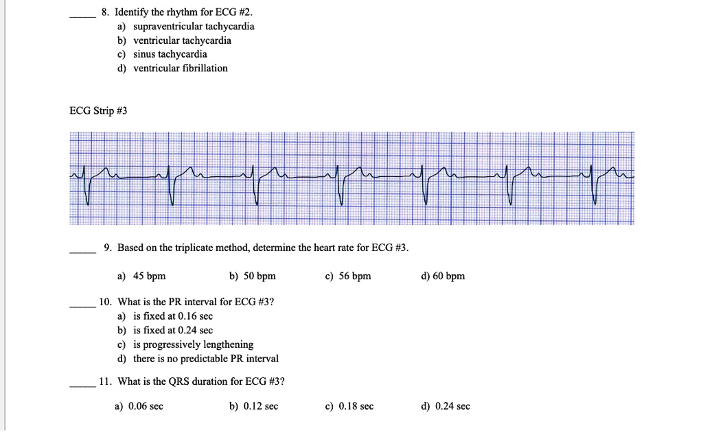 8. Identify the rhythm for ECG #2. a) supraventricular tachycardia b ...