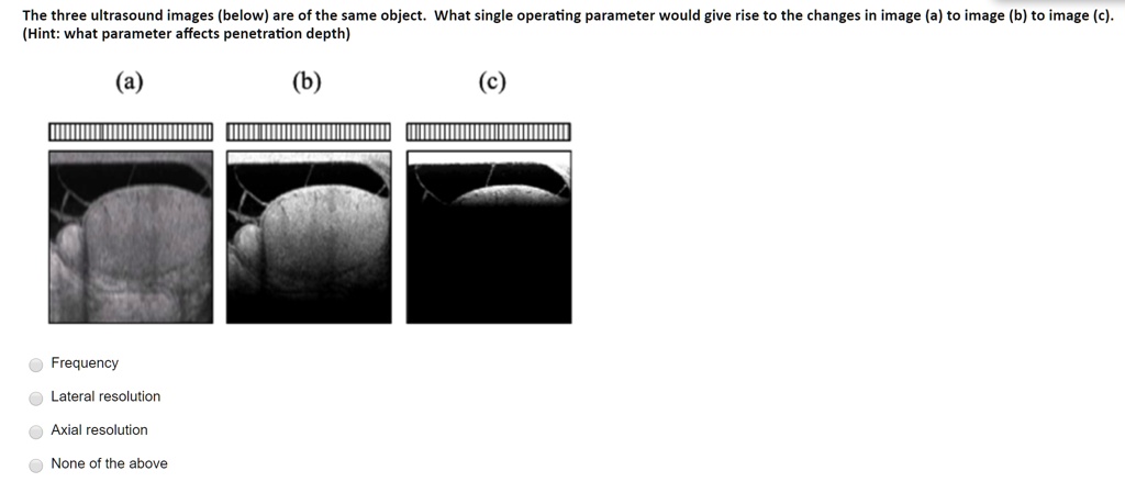 The three ultrasound images (below) are of the same object. What single operating parameter ...