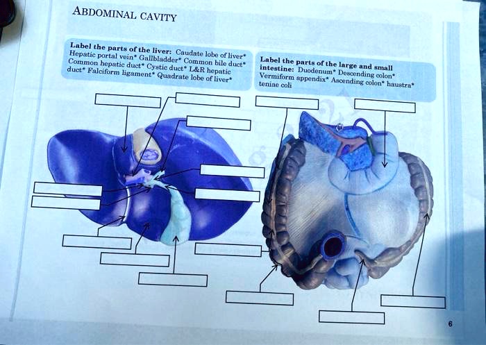 SOLVED: ABDOMINAL CAVITY Label the parts of the liver: Caudate lobe of ...