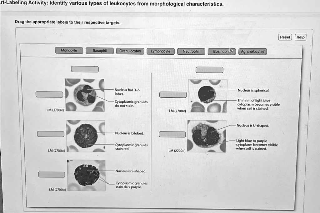 rt-Labeling Activity: Identify various types of leukocytes from ...