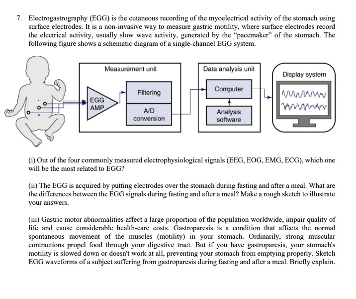 7. Electrogastrography (EGG) is the cutaneous recording of the ...