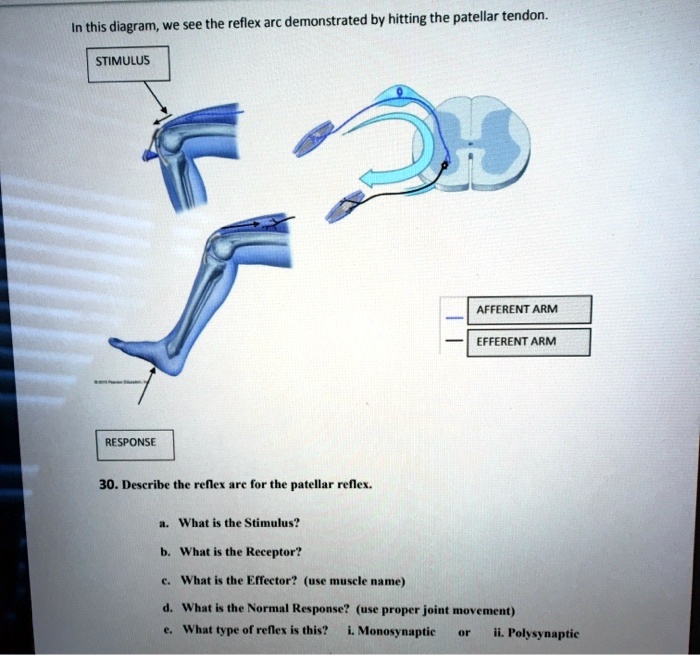 In this diagram, we see the reflex arc demonstrated by hitting the ...