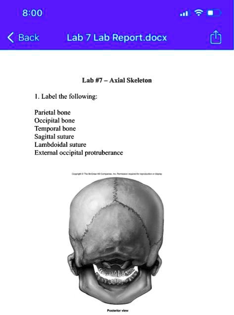 SOLVED: 8:00 Back Lab 7 Lab Report.docx Lab #7 - Axial Skeleton 1 ...