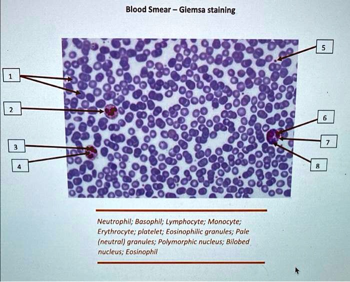 1 2 3 4 Blood Smear - Giemsa staining Neutrophil; Basophil; Lymphocyte ...