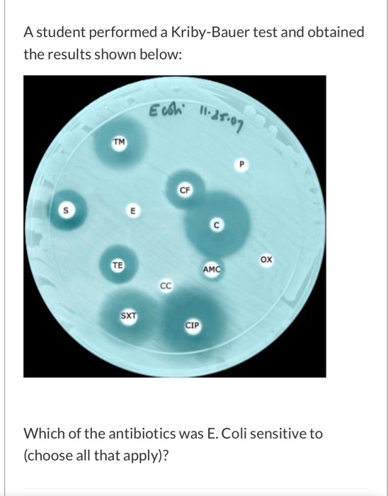 a student performed a kriby bauer test and obtained the results shown ...