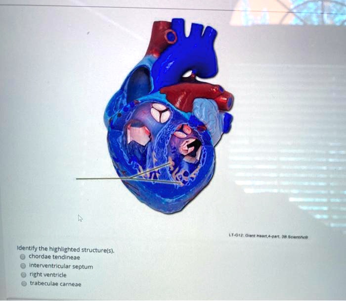 [GET ANSWER] w au ccet haaatn let ecintano identify the highlighted ...