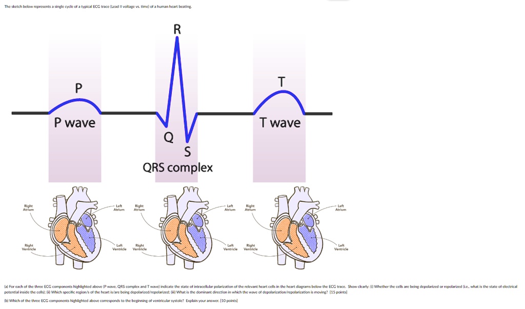 the sketch below represents a single cycle of a typical ecg trace lead ii voltage vs time of a ...