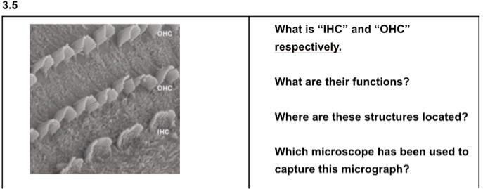 SOLVED: 3.5 What is "IHC" and "OHC" respectively What are their ...