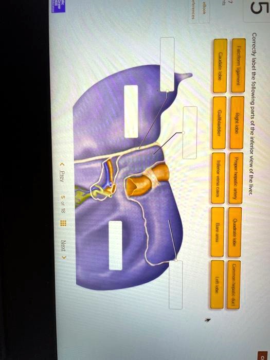 SOLVED: Caudate lobe, Falciform ligament, Right lobe. Correctly label the following parts of the ...