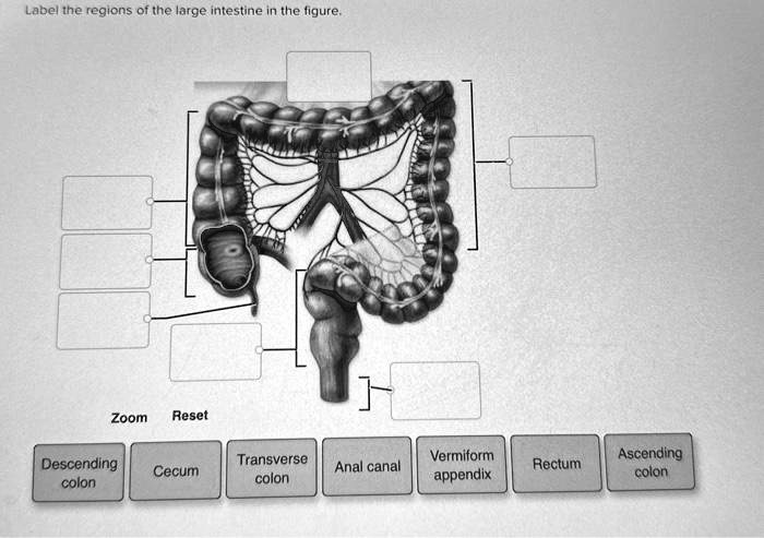 label the regions of the large intestine in the figure zoom reset ...