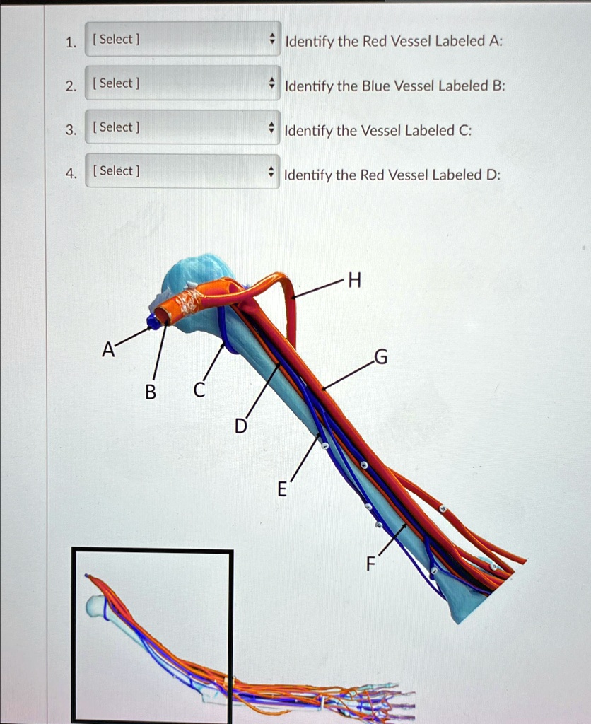 Identify the Red Vessel Labeled A: Identify the Blue Vessel Labeled B ... Identify the Red Vessel Labeled A: Identify the Blue Vessel Labeled B ...