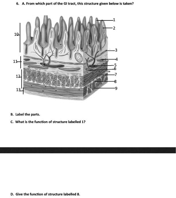 SOLVED: 6. A. From which part of the GI tract is this structure, given ...