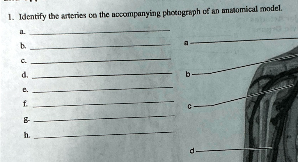 1. Identify the arteries on the accompanying photograph of an ...