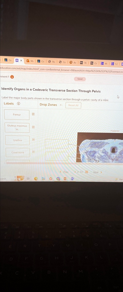 SOLVED: Identify Organs in a Cadaveric Transverse Section Through ...
