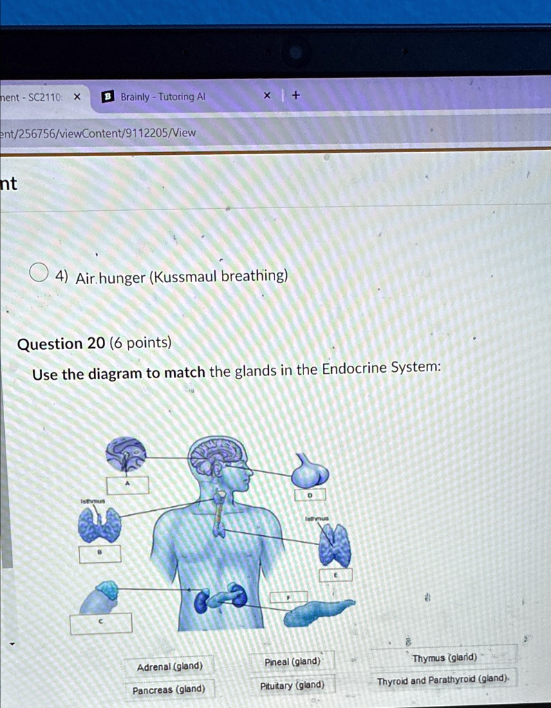 air hunger kussmaul breathing question 20 6 points use the diagram to ...