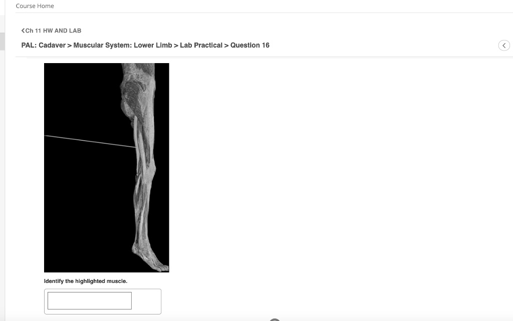SOLVED: PAL: Cadaver > Muscular System: Lower Limb > Lab Practical ... SOLVED: PAL: Cadaver > Muscular System: Lower Limb > Lab Practical ...