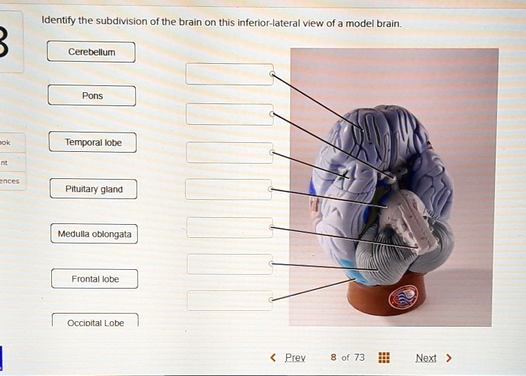 Identify the subdivision of the brain on this inferior-lateral view of ...